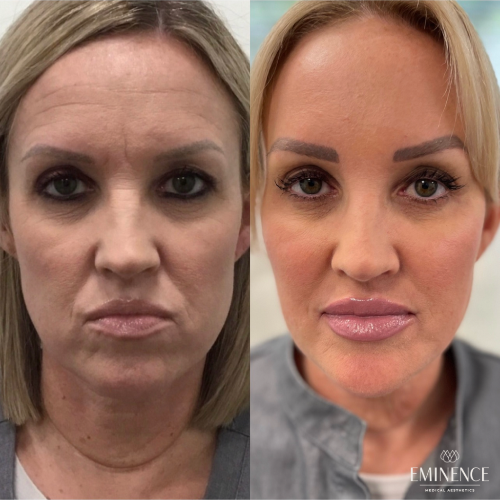 Combo Treatments | Princeton, Montgomery NJ Eminence